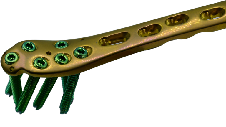 Proximal Femur Locking Plate - Deva Tibbi
